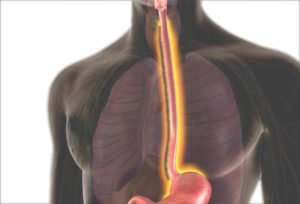 O que não pode comer quando se tem Esofagite